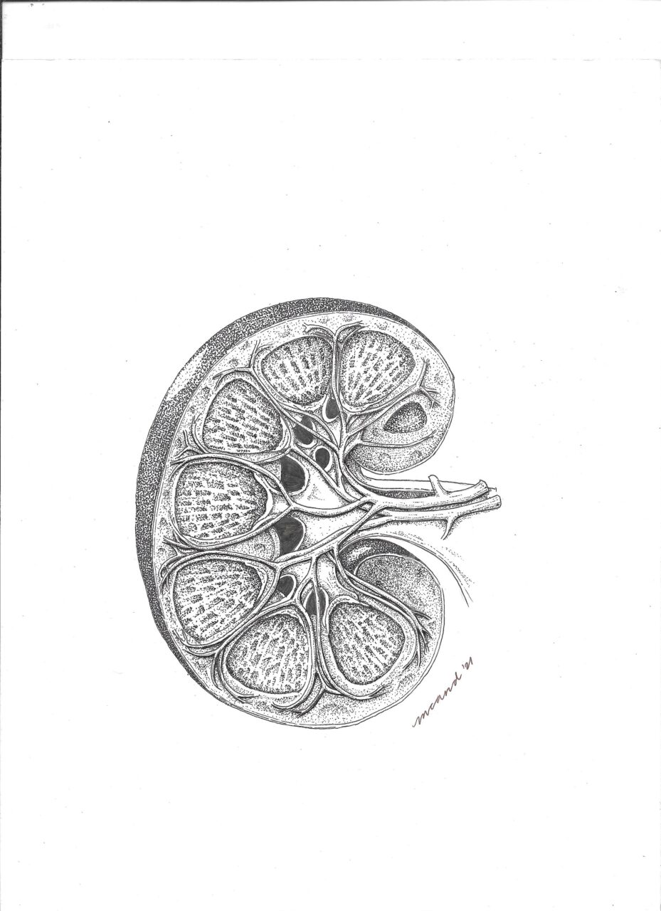 NDT Kidney Art Gallery | ERA