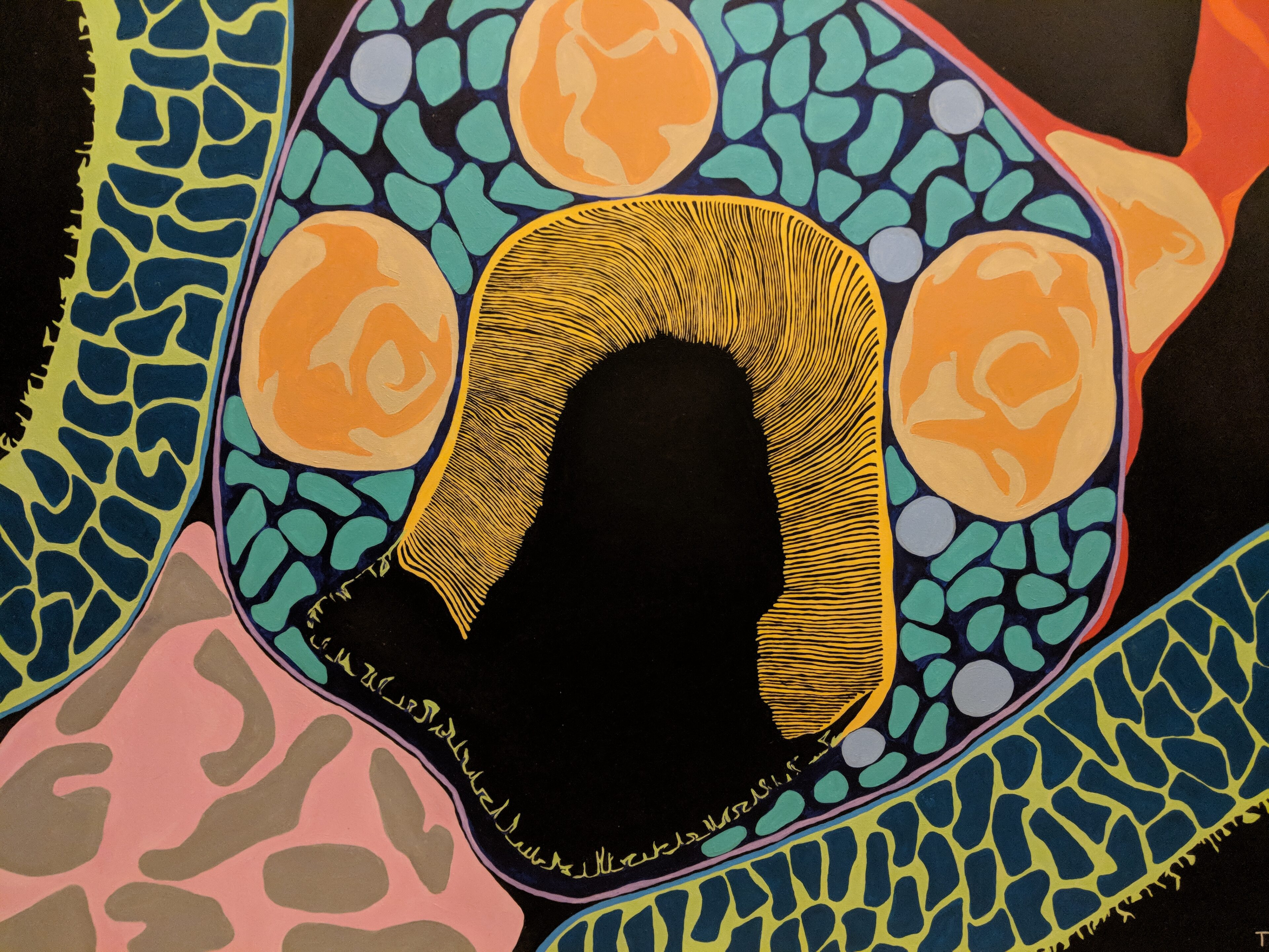 NDT Kidney Art Gallery | ERA