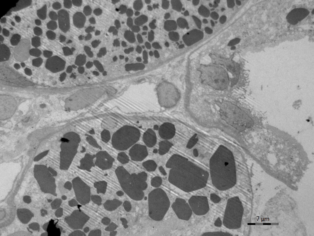 NDT Kidney Art Gallery | ERA