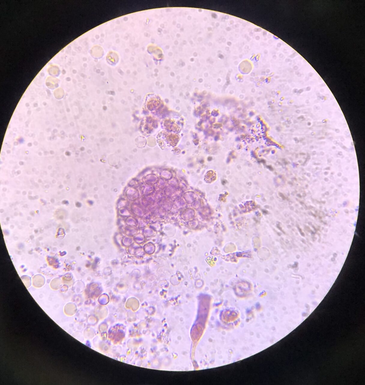 NDT Kidney Art Gallery | ERA