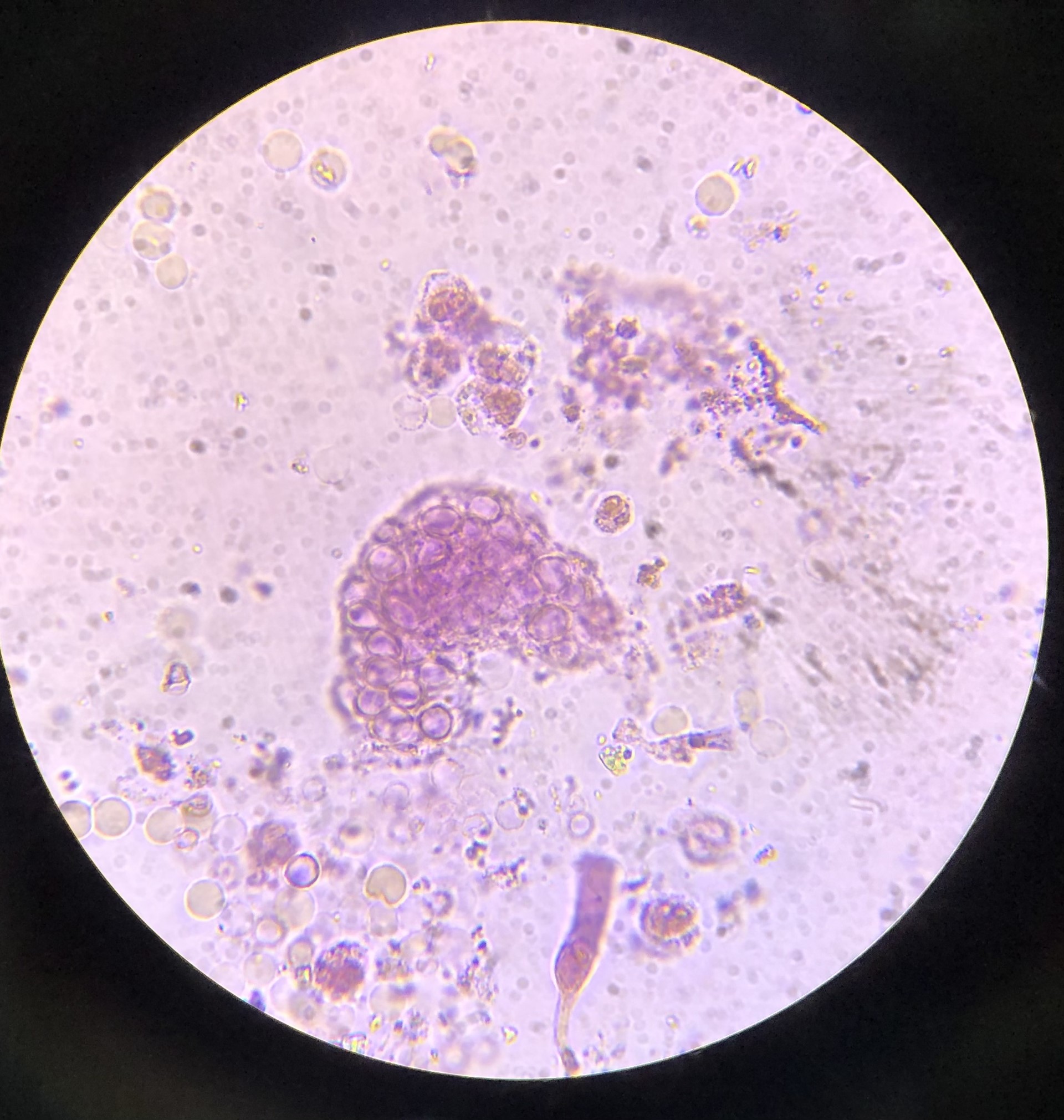 NDT Kidney Art Gallery | ERA