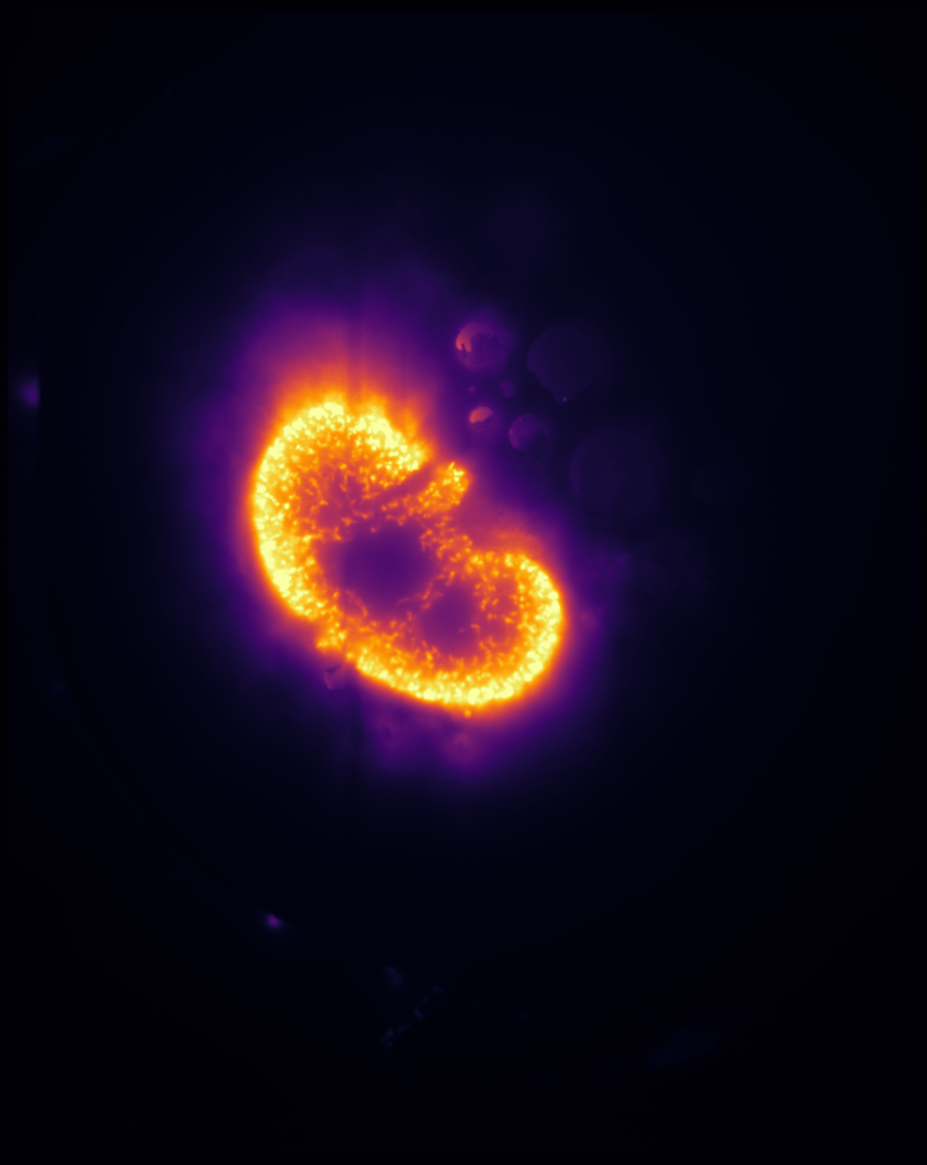 NDT Kidney Art Gallery | ERA