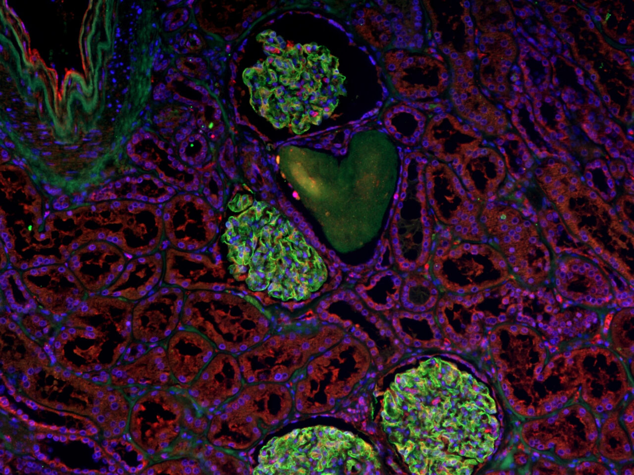 NDT Kidney Art Gallery | ERA