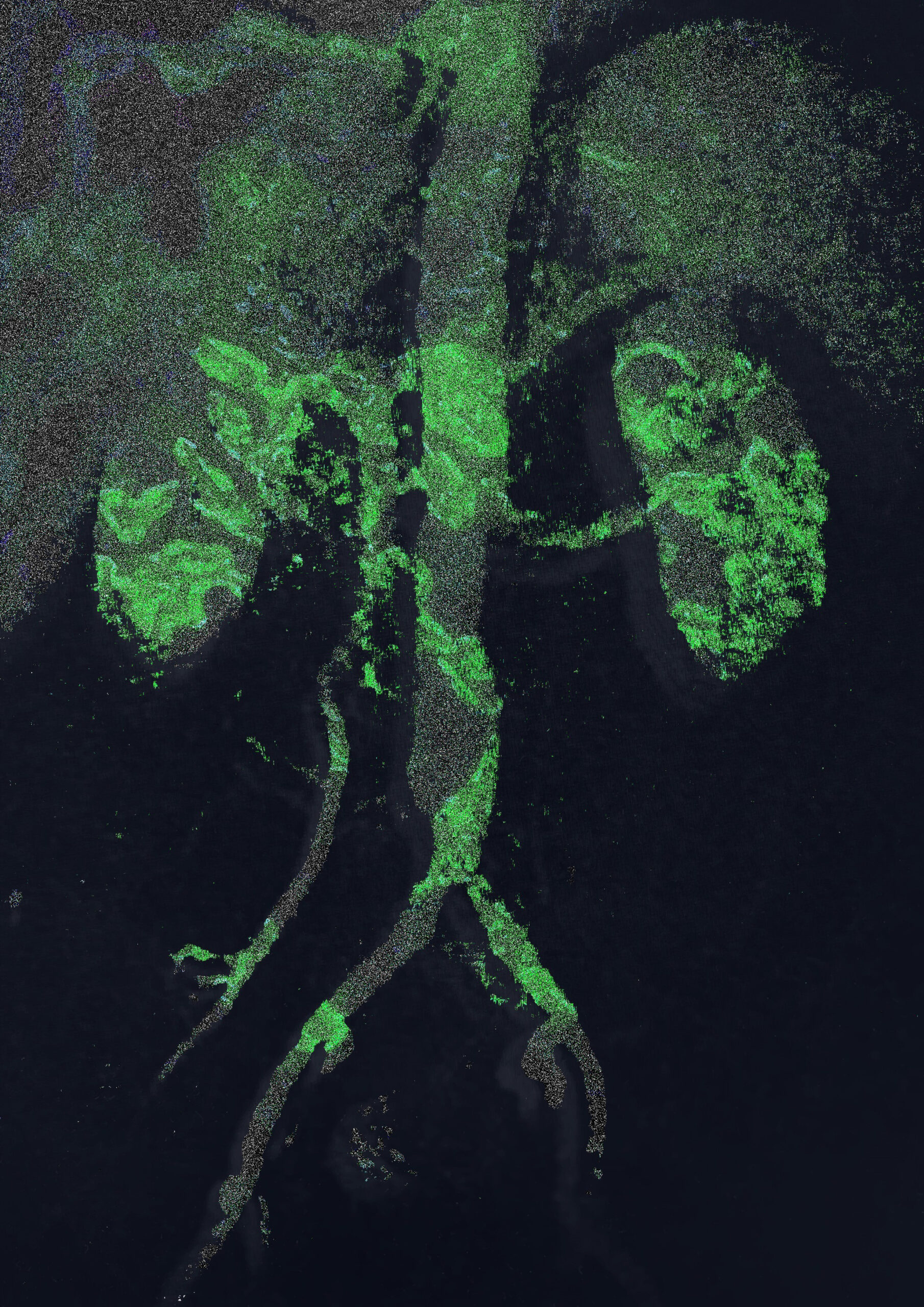 NDT Kidney Art Gallery | ERA