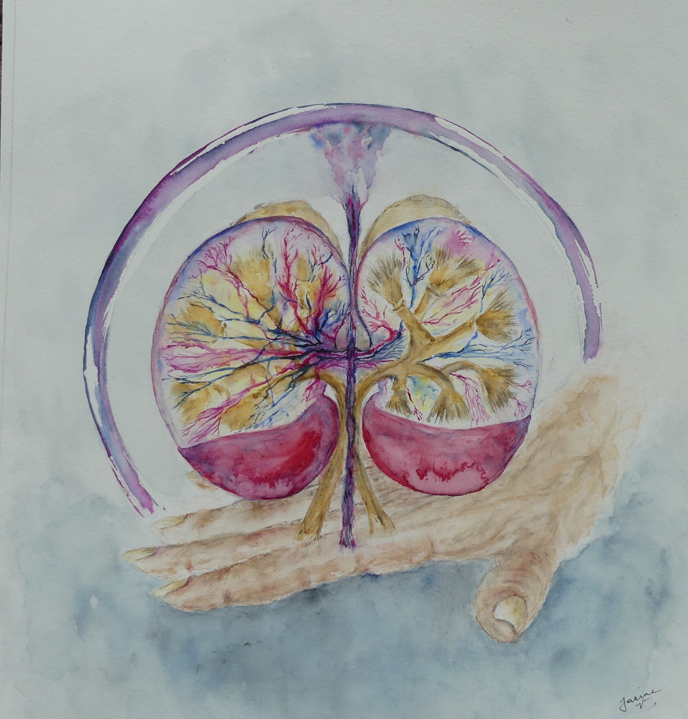 NDT Kidney Art Gallery | ERA