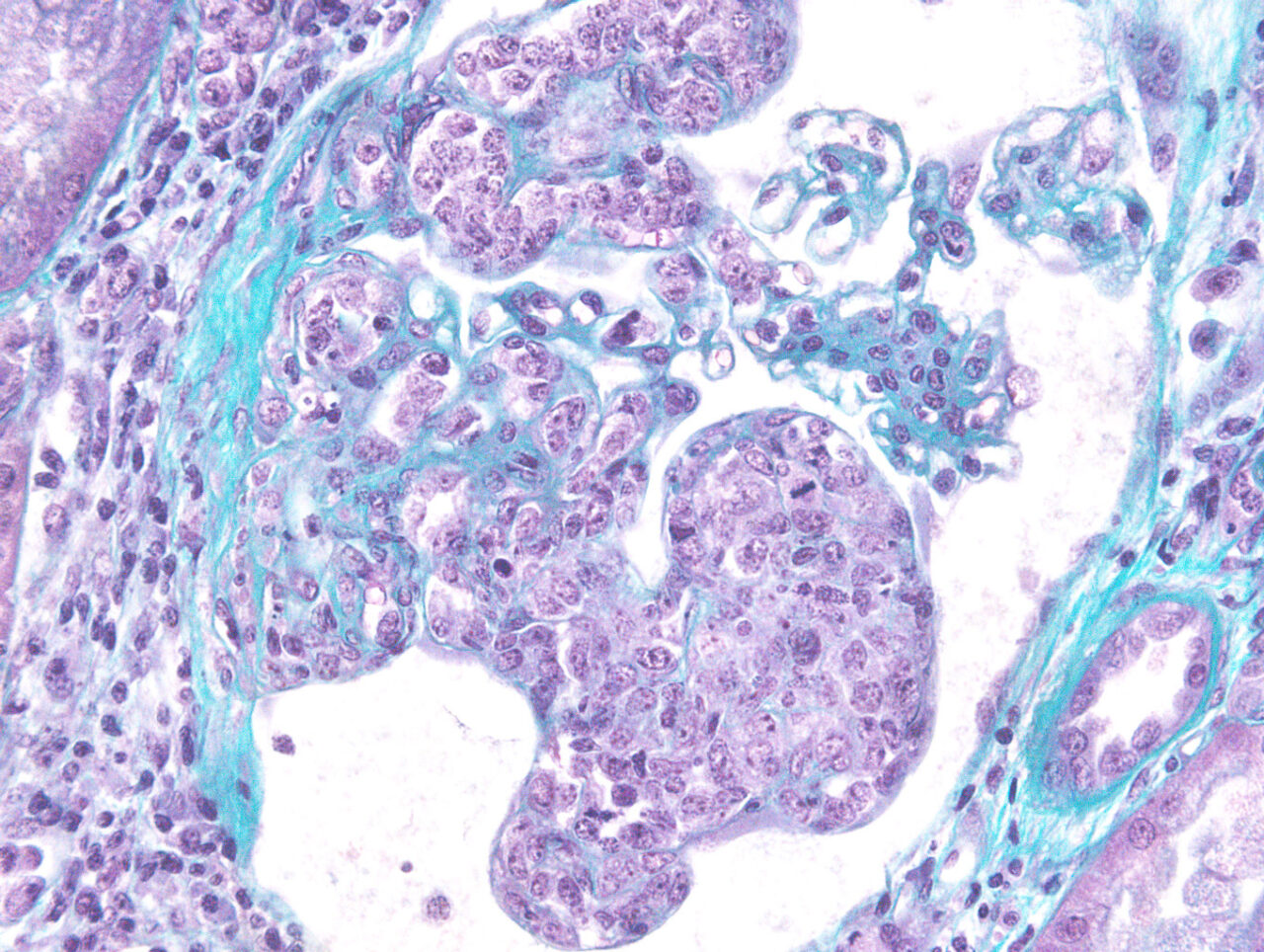 NDT Kidney Art Gallery | ERA