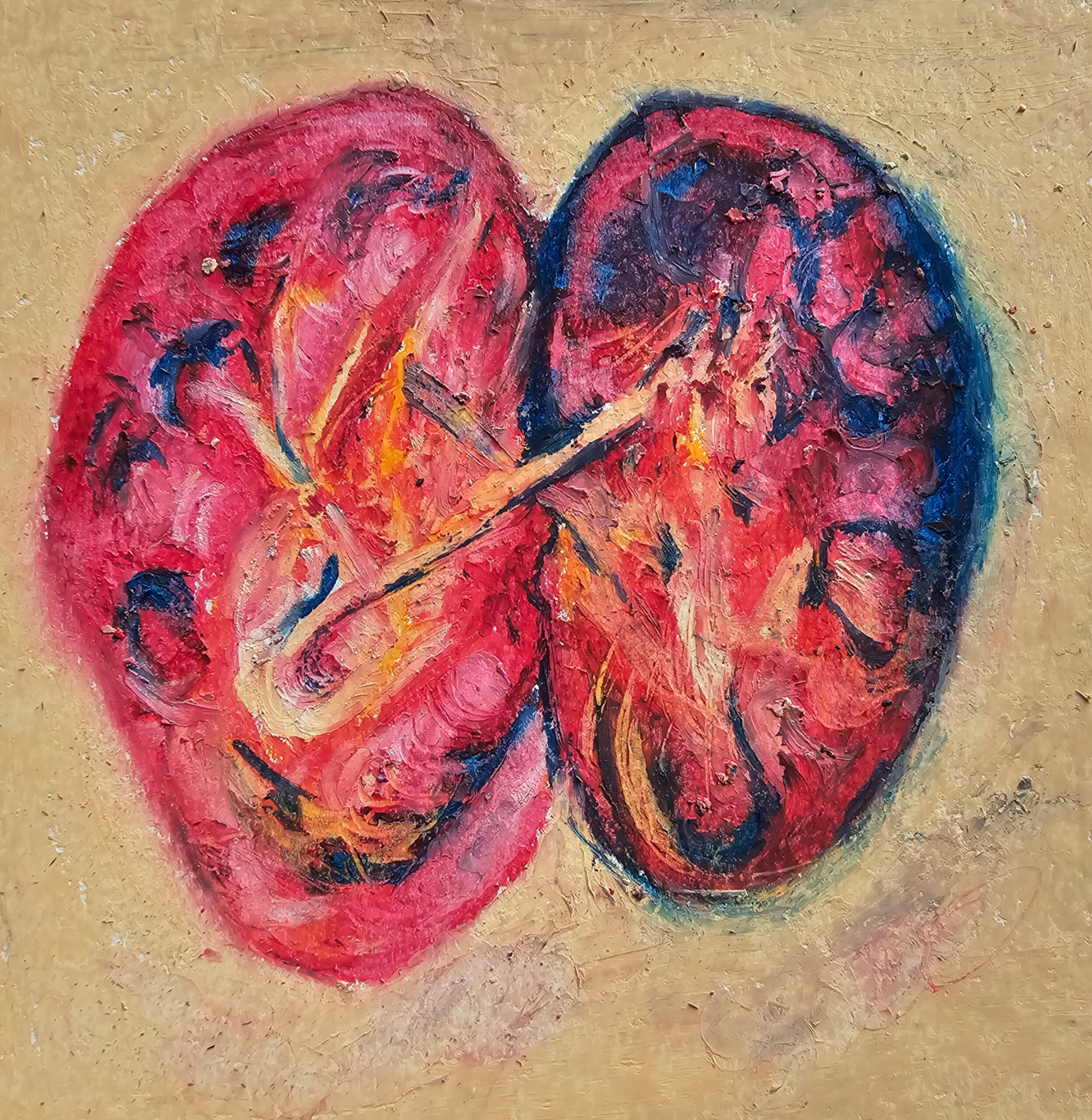 NDT Kidney Art Gallery | ERA