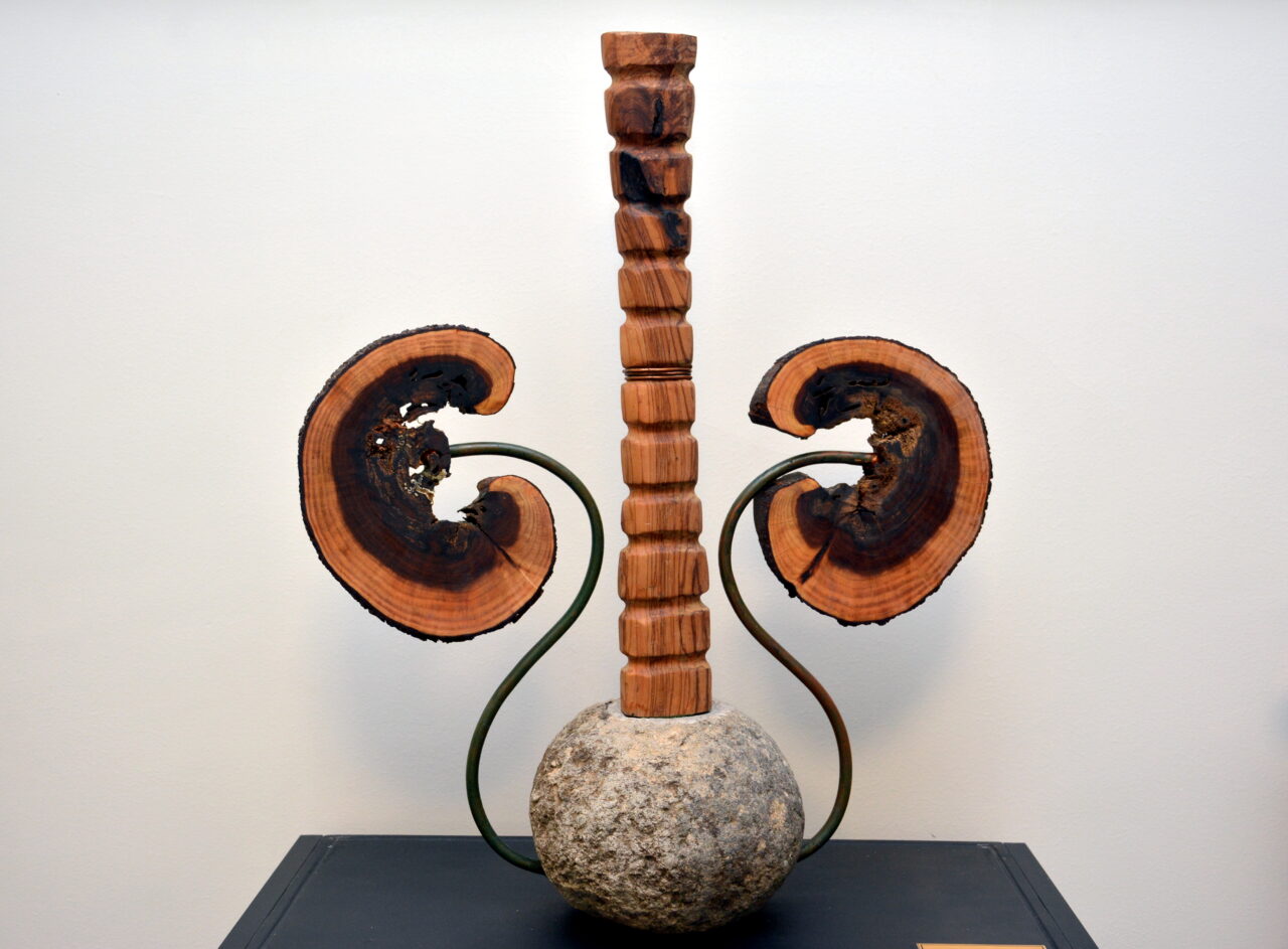 NDT Kidney Art Gallery | ERA