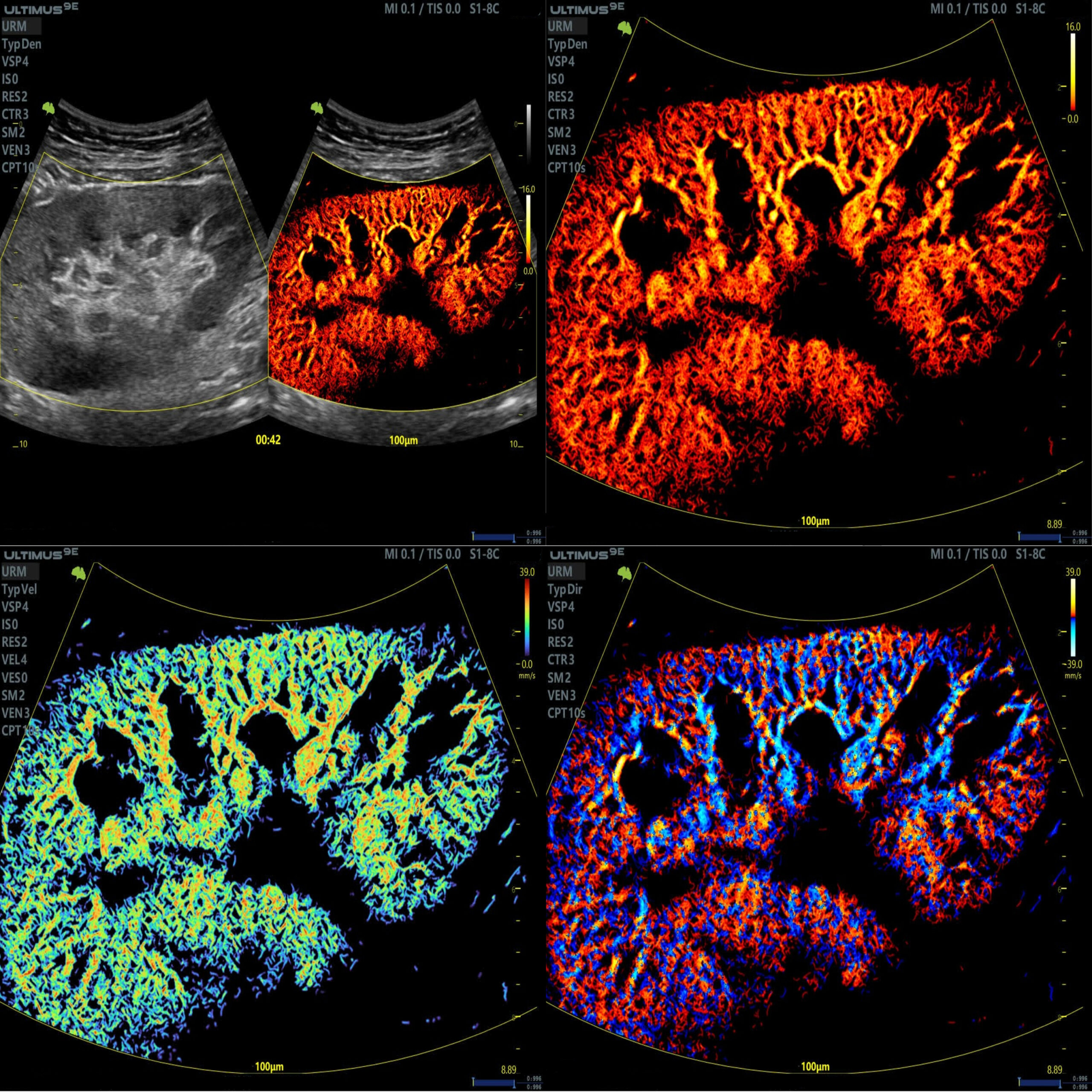 NDT Kidney Art Gallery | ERA