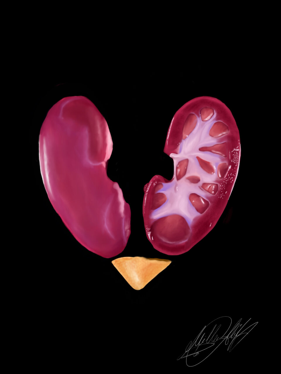 NDT Kidney Art Gallery | ERA