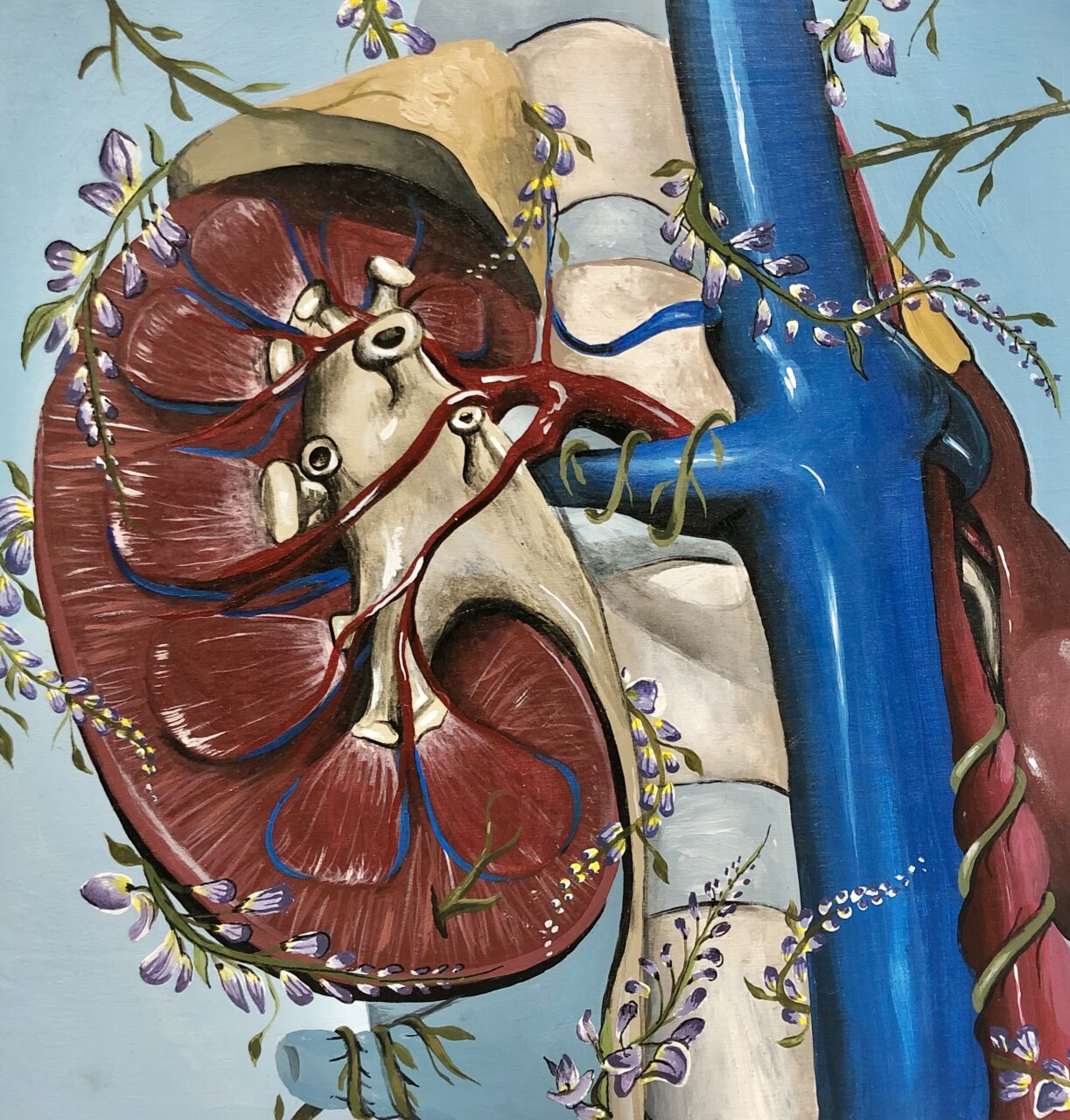 NDT Kidney Art Gallery | ERA